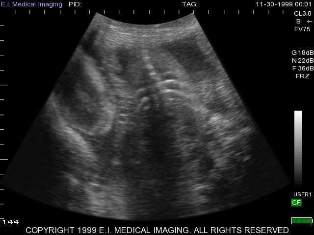 No Limits To Portable Ultrasound; Mule Deer Ultrasound