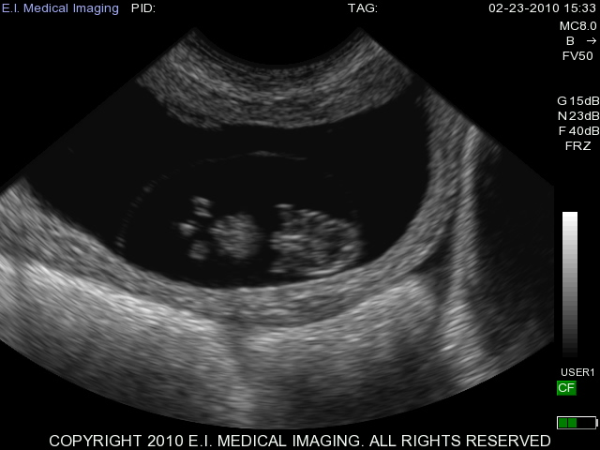 Veterinary Ultrasound | cow ultrasound
