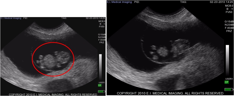 IBEX® Ultrasound: Stages of Early Bovine Pregnancy, part 1