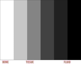 Ultrasound Basics: How to Read an Ultrasound Image