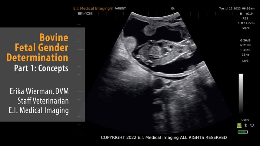 FETAL GENDER DETERMINATION VIDEO SERIES